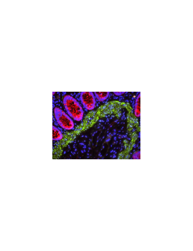 VECTASHIELD®️ PLUS Antifade Mounting Medium with DAPI