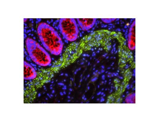 VECTASHIELD®️ PLUS Antifade Mounting Medium with DAPI