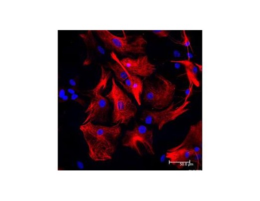 DyLight 594 Streptavidin